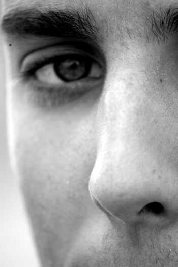 Roman Nose: Definition, Surgery and How to Improve Your Profile